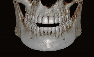 Smart Plus – Vatech UK