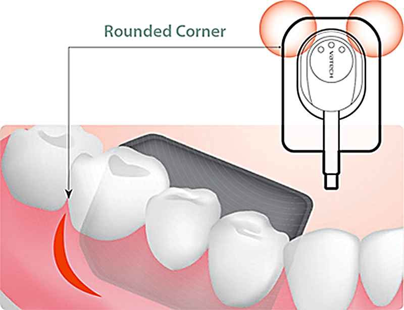 EzSensor Classic – Vatech UK