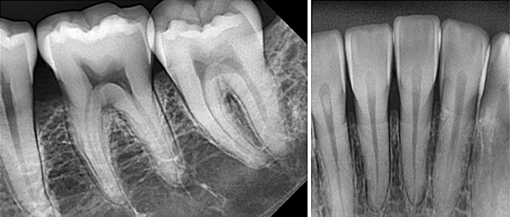 EzSensor HD – Vatech UK
