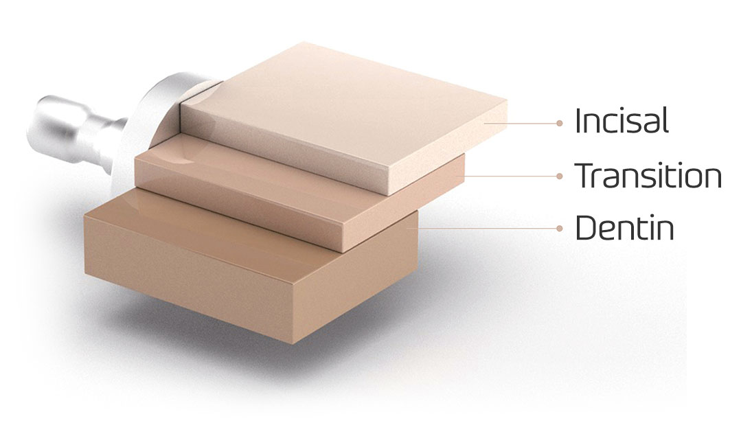 Perfit FS – Vatech UK