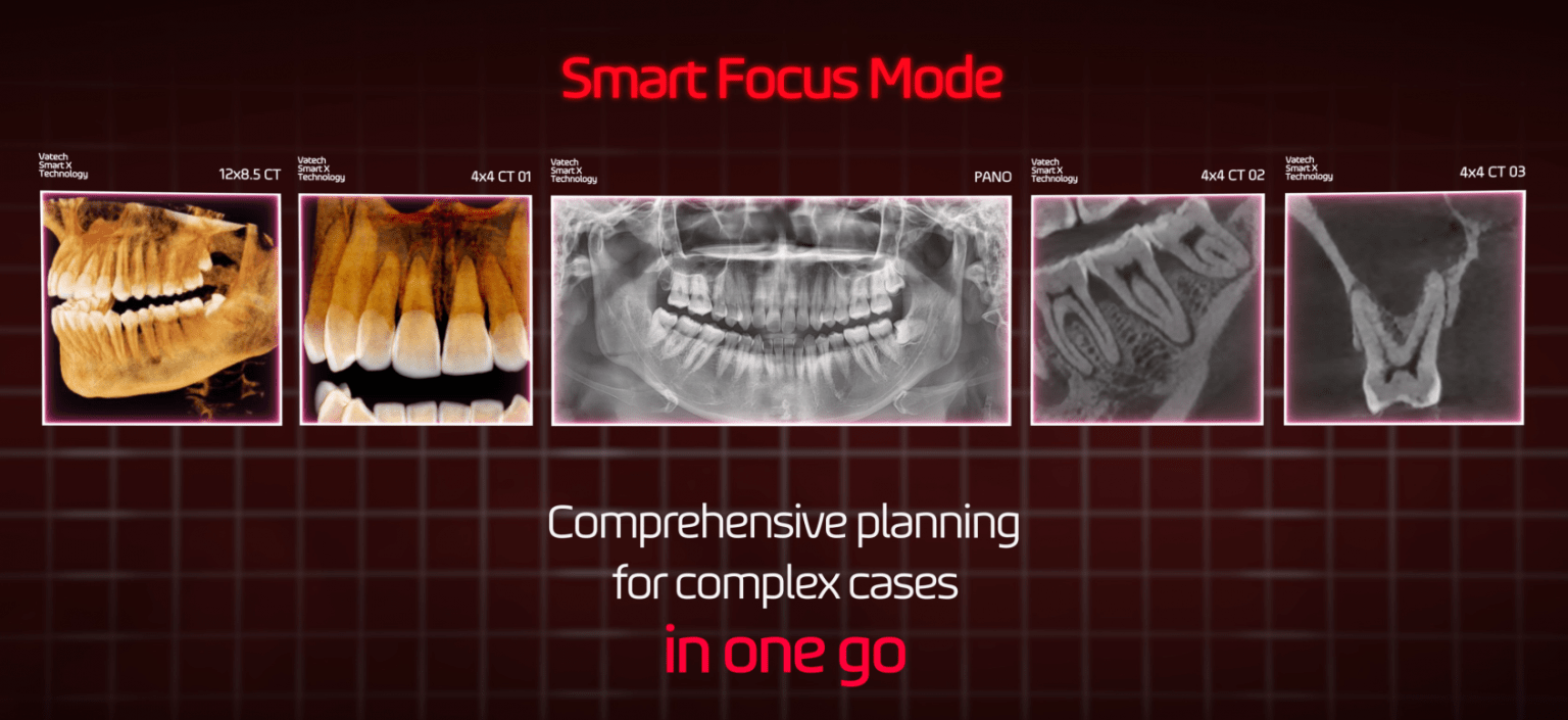 Smart X – Vatech UK